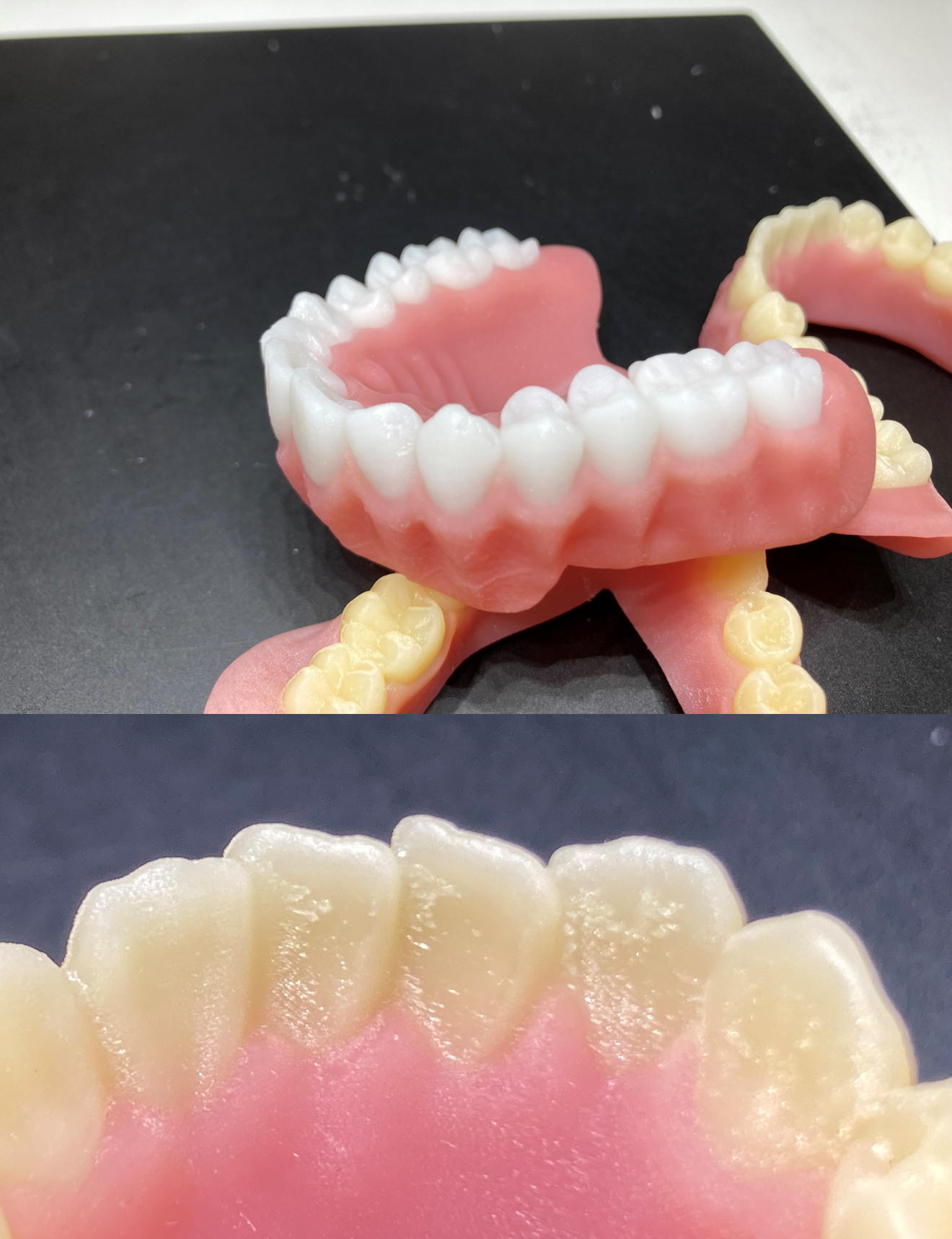 NextDent 300 Part Quality Issue Recovery