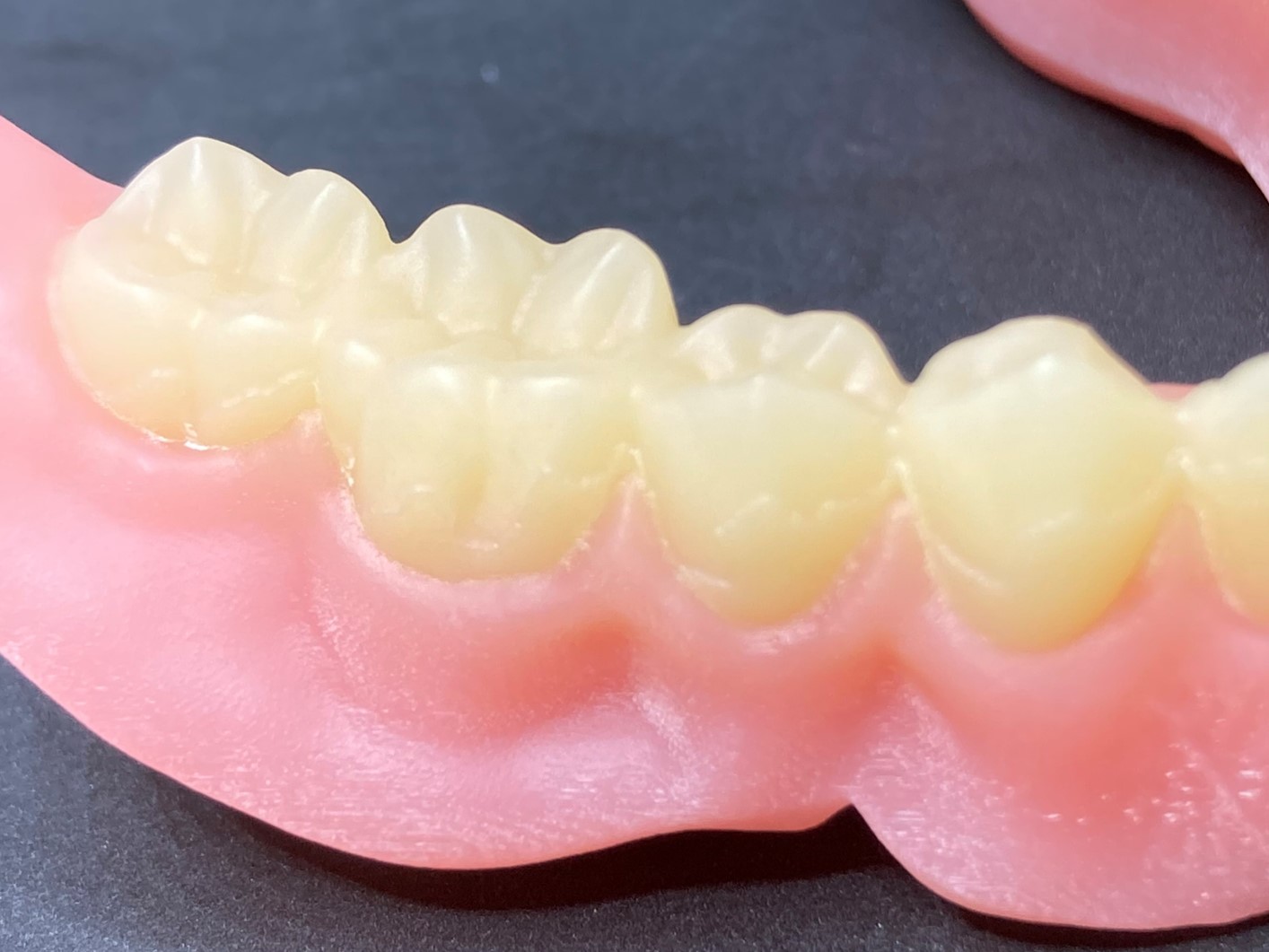 NextDent 300 Part Quality Issue Recovery