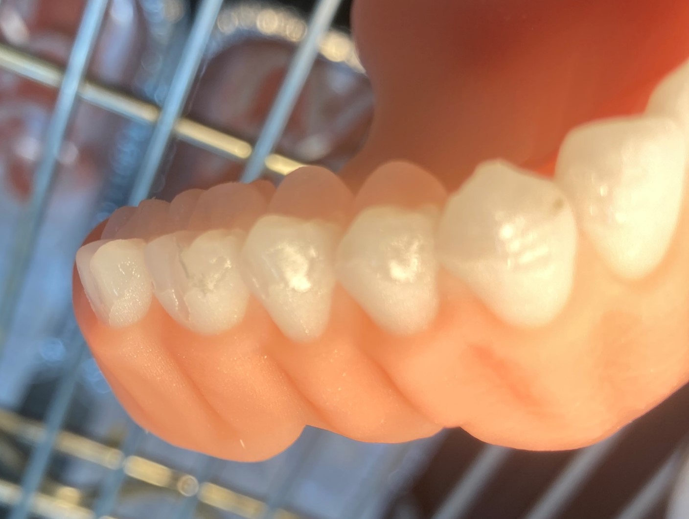 NextDent 300 Part Quality Issue Recovery