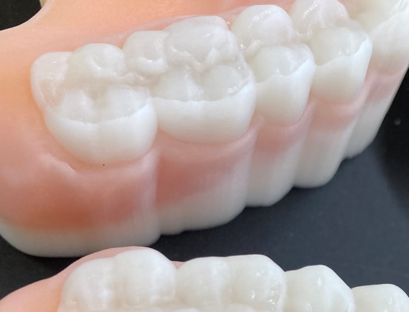 NextDent 300 Part Quality Issue Recovery