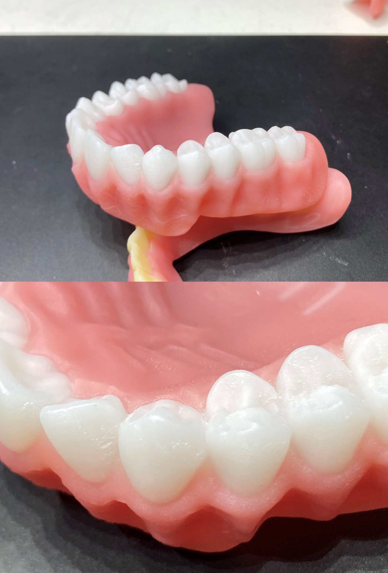 NextDent 300 Part Quality Issue Recovery