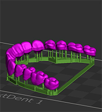 NextDent Print Material Quick Reference