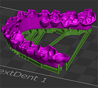 NextDent Print Material Quick Reference