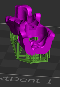 NextDent Print Material Quick Reference