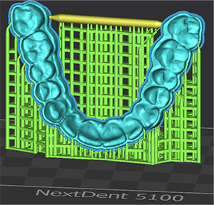 NextDent Print Material Quick Reference