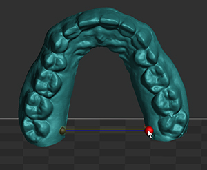 NextDent Model 2.0 Orthodontic