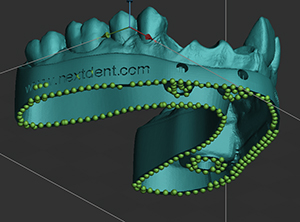 NextDent Model 2.0 Prosthodontic