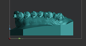NextDent Model 2.0 Orthodontic