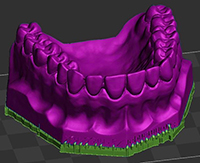 NextDent Print Material Quick Reference