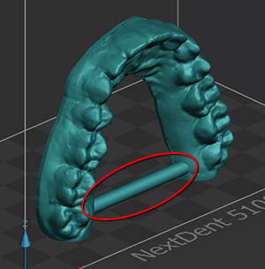 NextDent Model 2.0 Orthodontic