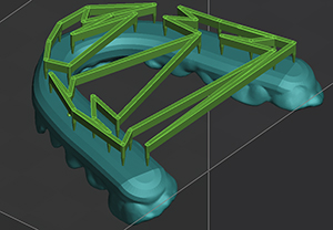 NextDent Ortho Rigid