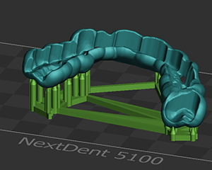 NextDent Surgical Guide