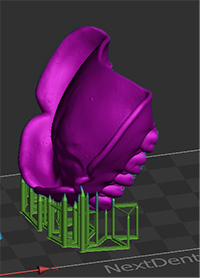 NextDent Print Material Quick Reference