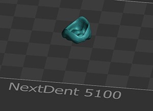 Crowntec for NextDent