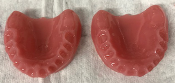 NextDent 5100 Dry the Build Parts