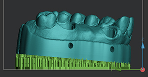 NextDent Model 2.0 Premium