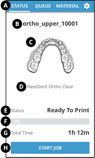 NextDent 5100 Status Tab